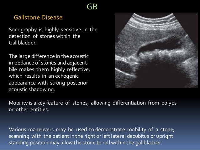 Usg gb & biliary t