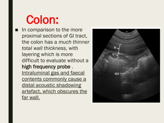 USG GI tract of dog prepare by dr.Pravin Chaudhary.pptx