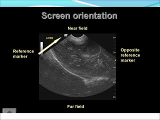 Usg guided FNA biopsy | PPT