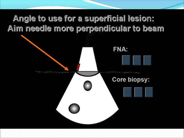 Usg guided FNA biopsy | PPT