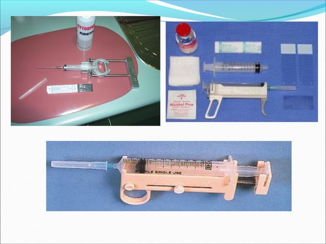 Usg guided FNA biopsy | PPT