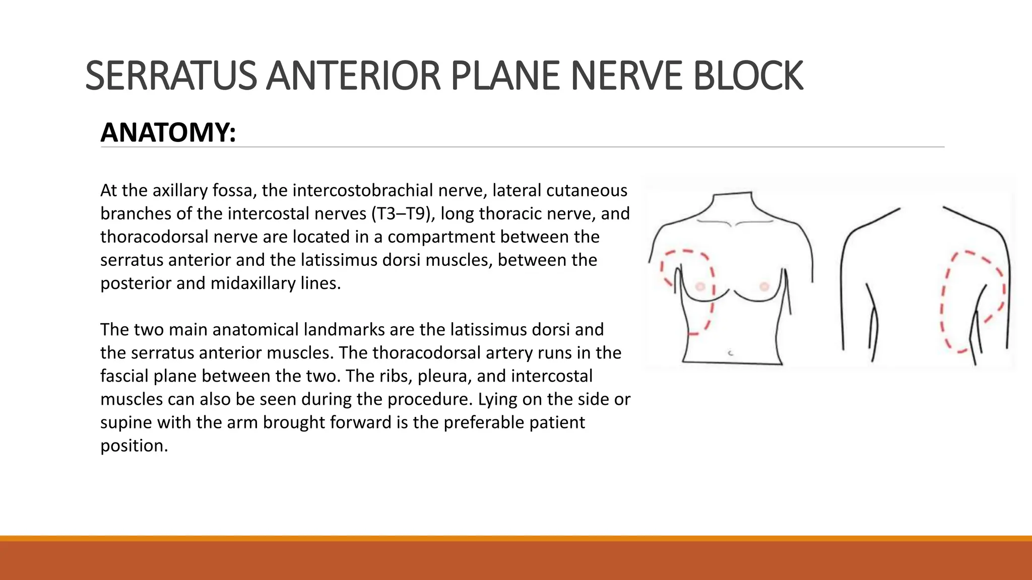 USG GUIDED NERVE BLOCKS PEC 1 PEC 2 BLOCK | PPTX