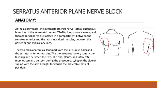 USG GUIDED NERVE BLOCKS PEC 1 PEC 2 BLOCK | PPTX | Death, Injury, or Military Conflict ...