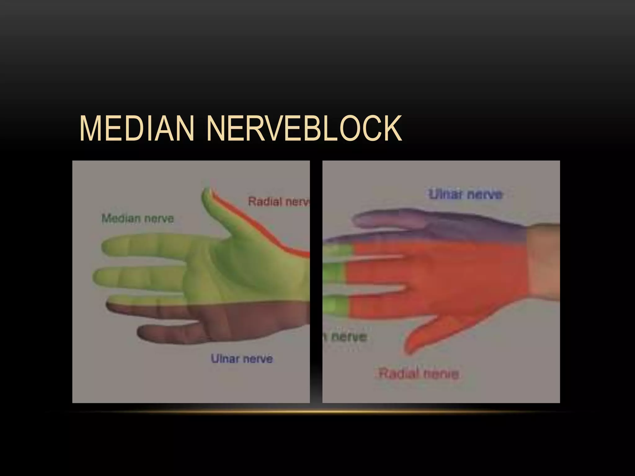 Ultrasound guided nerves block | PPTX
