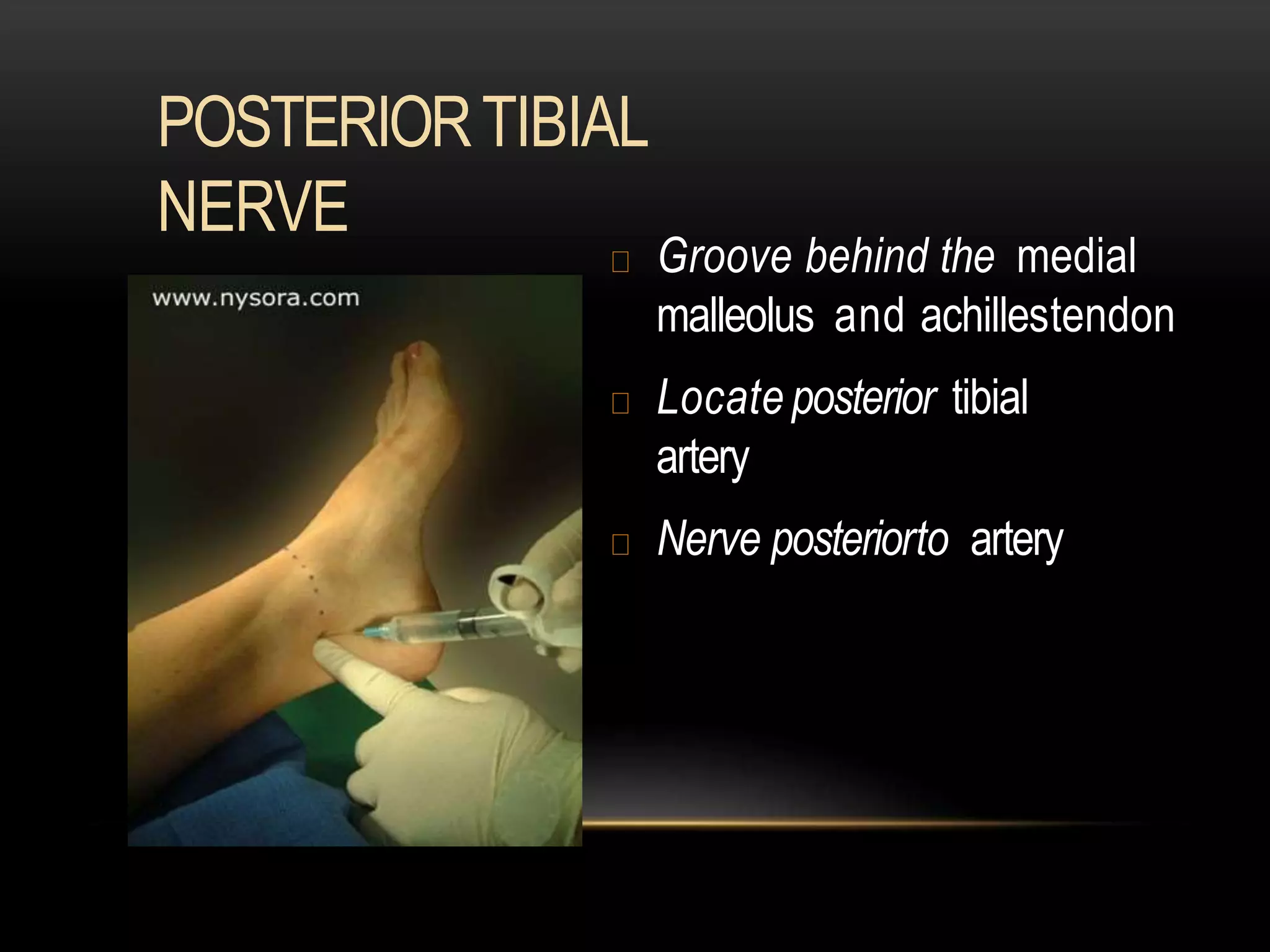 Ultrasound guided nerves block | PPTX