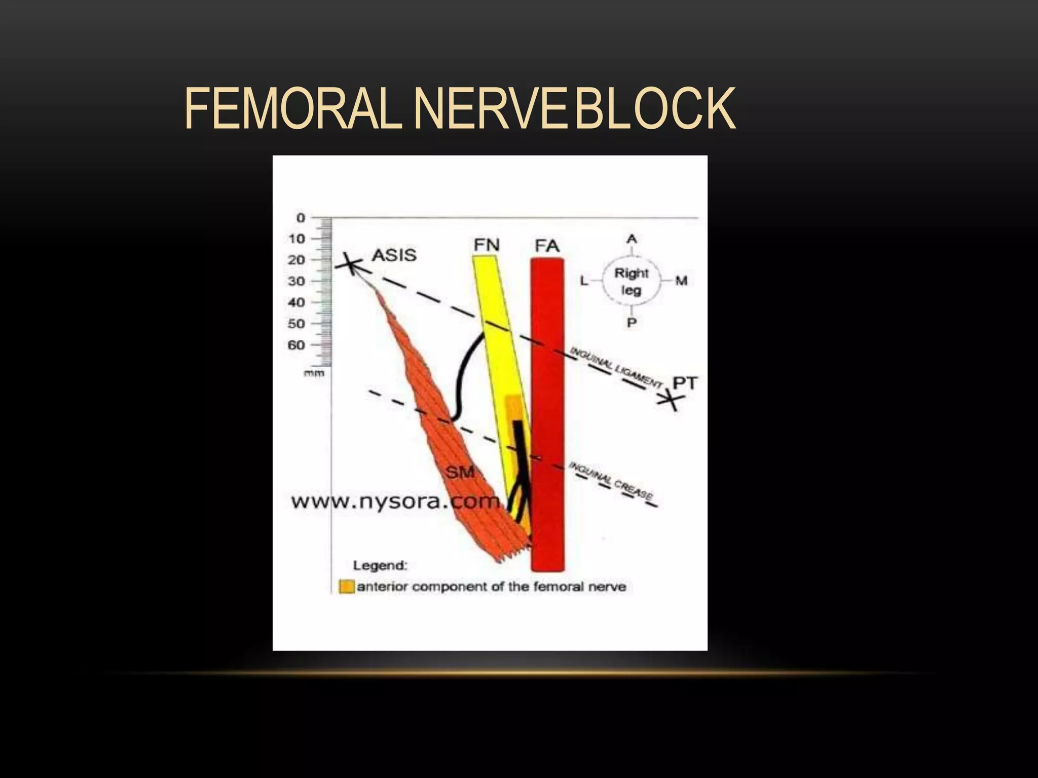 Ultrasound guided nerves block | PPTX