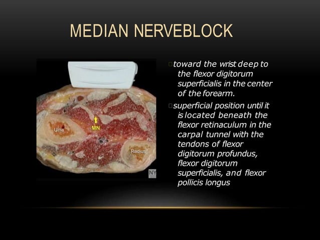 Ultrasound guided nerves block | PPTX | Death, Injury, or Military ...