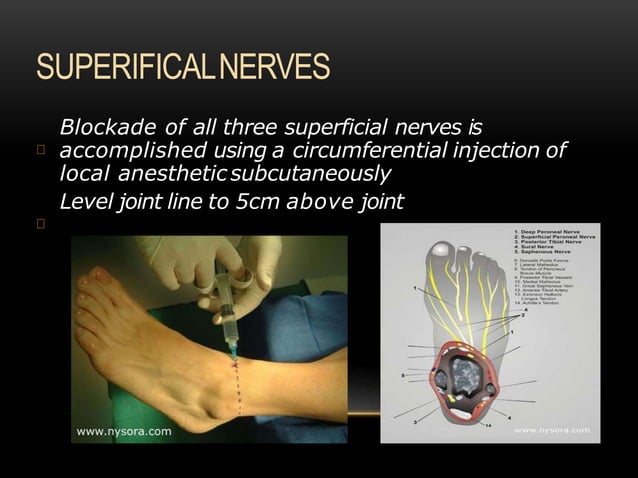 Ultrasound guided nerves block | PPTX | Death, Injury, or Military ...