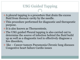 USG Guided Tapping.pptx,Lung Infection Symptom relief (if pleural ...