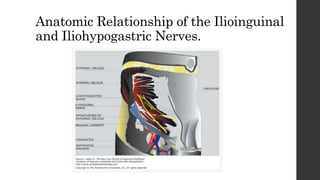USG Guiding Iliohypogastric Nerve Block.pptx