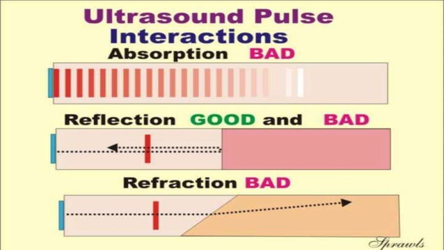 Usg Basics | PPTX