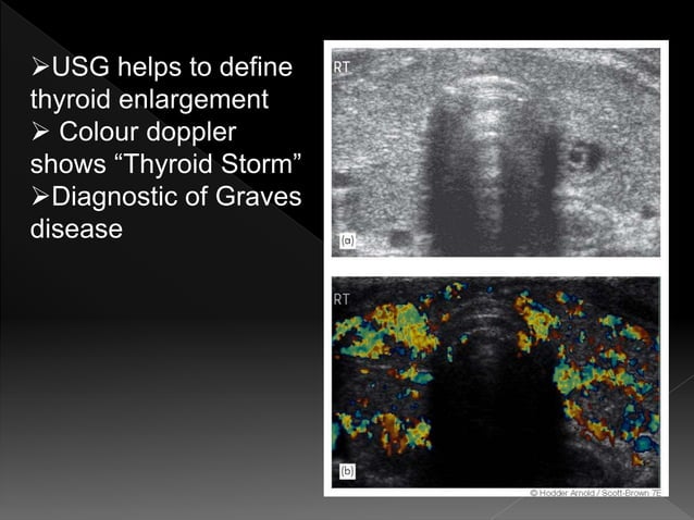 Usg head and neck | PPTX