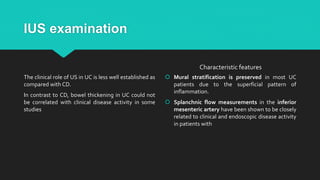 Diagnostics in Inflammatory Bowel Disease (IBD): Ultrasound | PPTX
