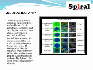 Usg image gallery advanced usg lounge | PPT