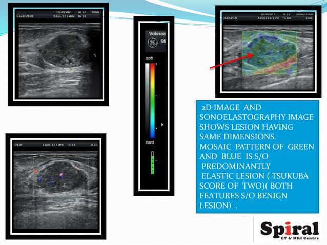 Usg image gallery advanced usg lounge | PPT