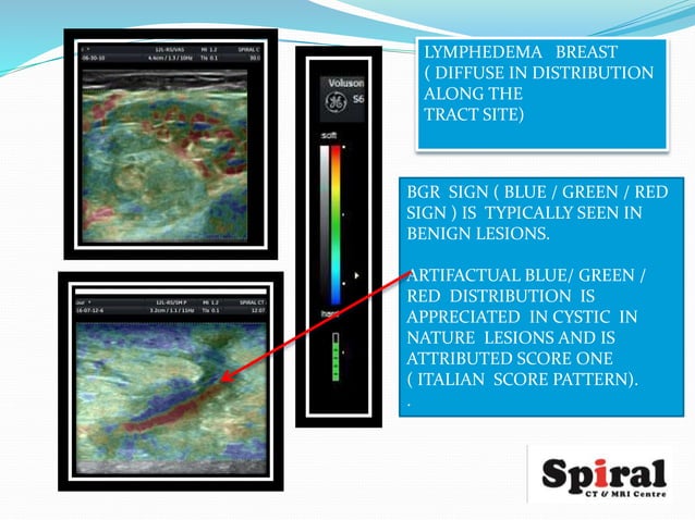 Usg image gallery advanced usg lounge | PPT