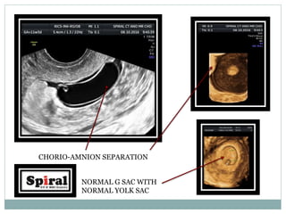 Usg image gallery nov 16 | PPT