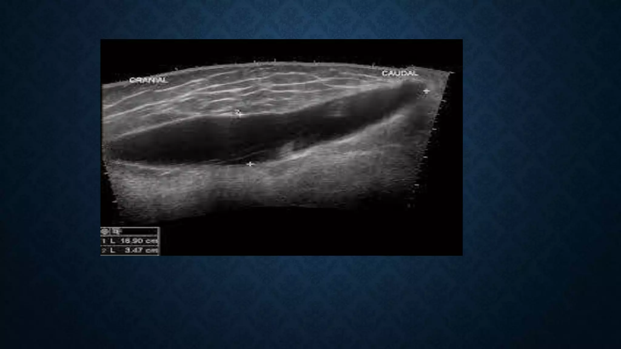 Usg in abdominal trauma.pptx