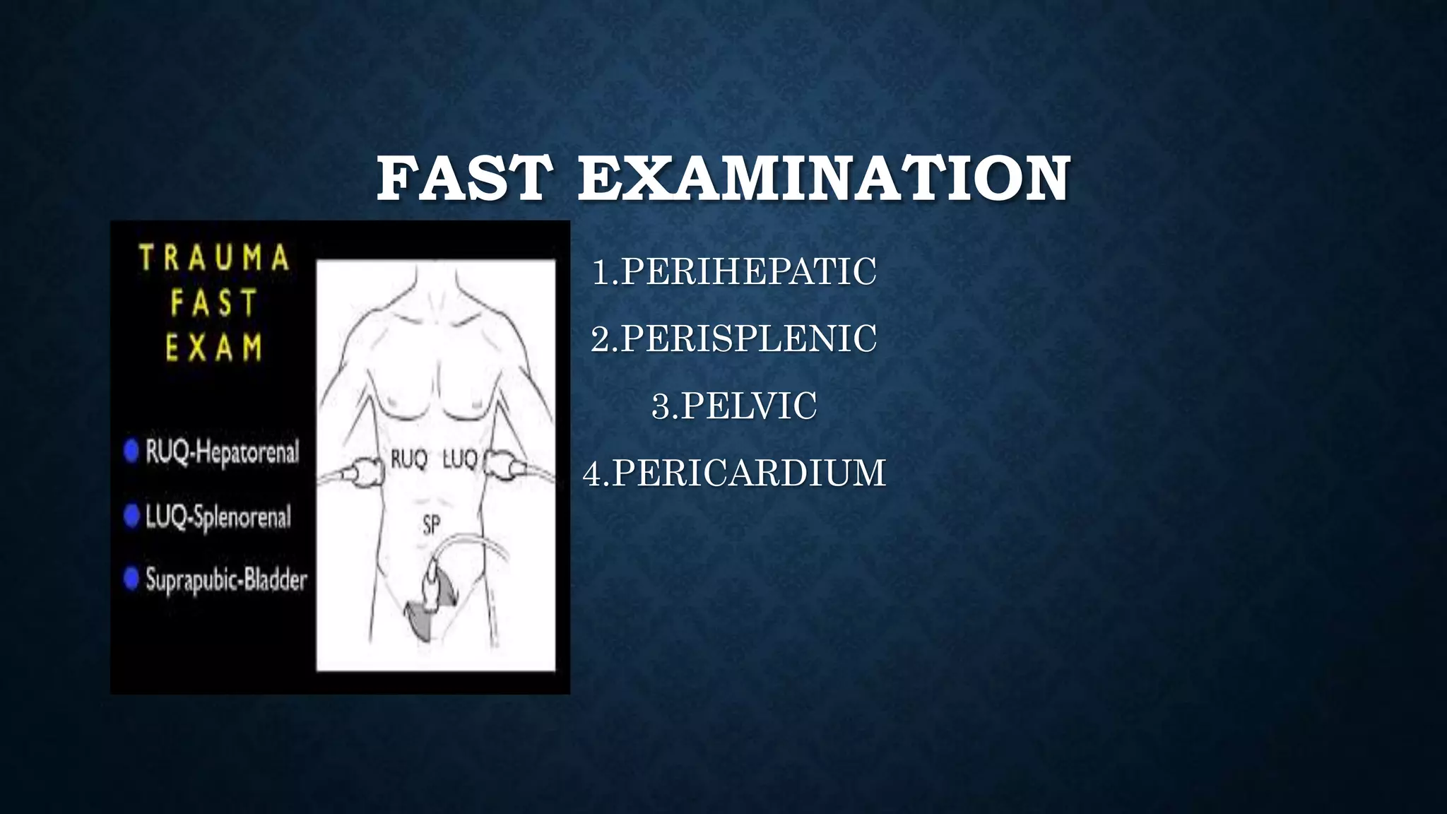 Usg in abdominal trauma.pptx