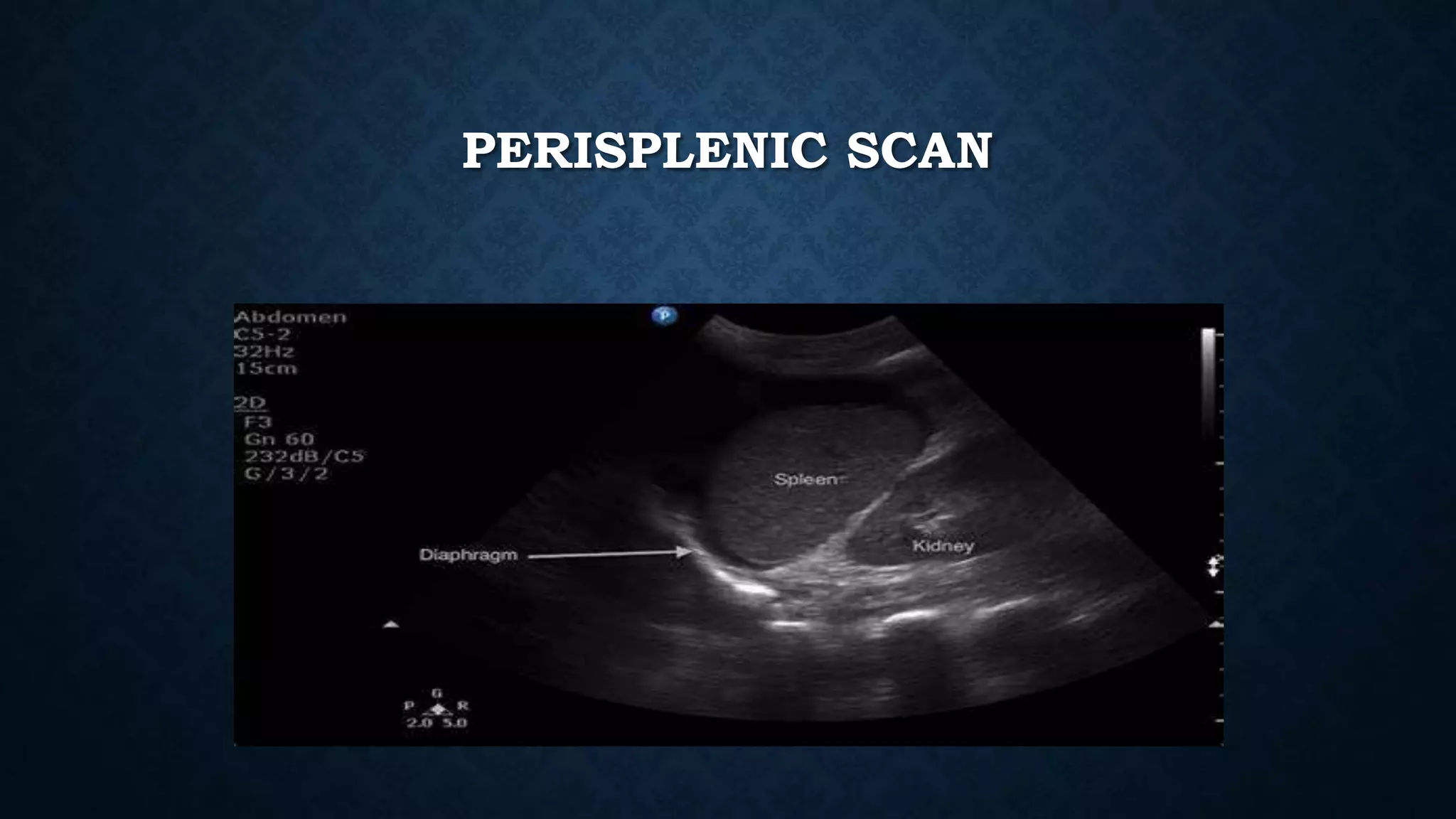 Usg in abdominal trauma.pptx
