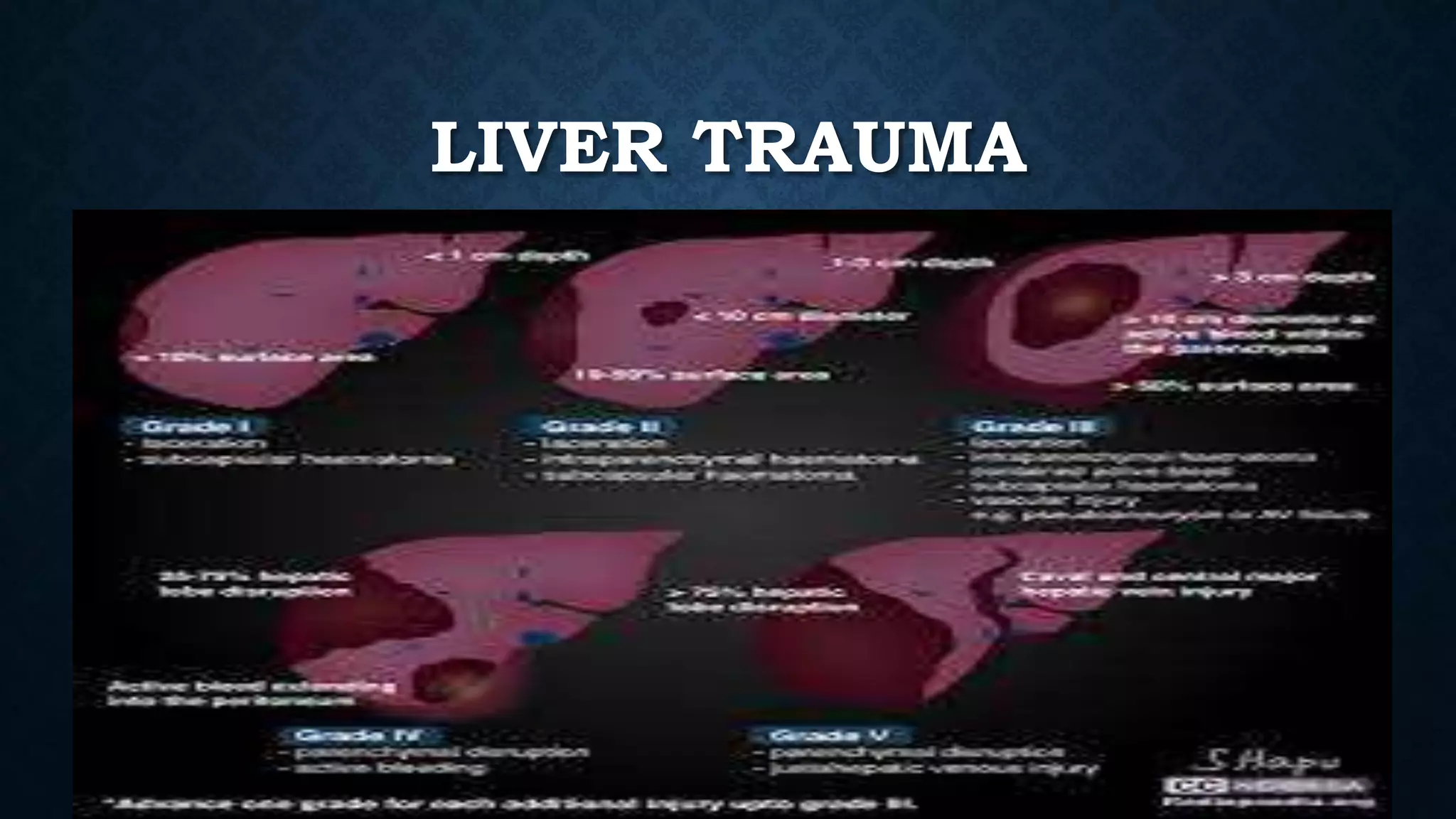 Usg in abdominal trauma.pptx