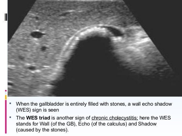 USG in gall bladder pathologies