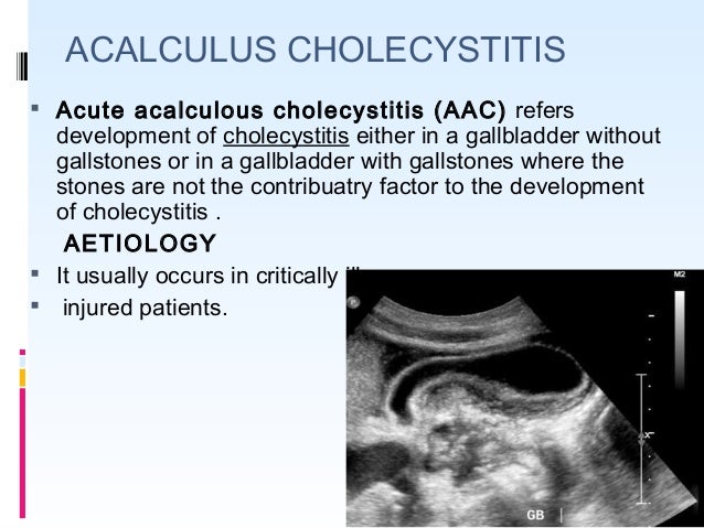 Acute Acalculous Cholecystitis Gallbladder Disease