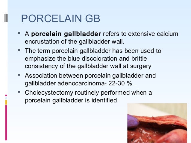 USG in gall bladder pathologies