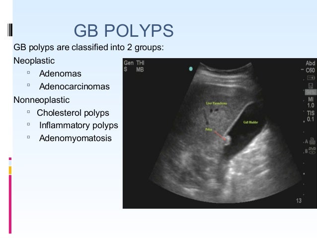 USG in gall bladder pathologies