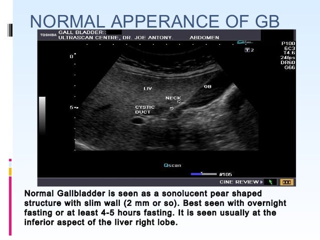 USG in gall bladder pathologies