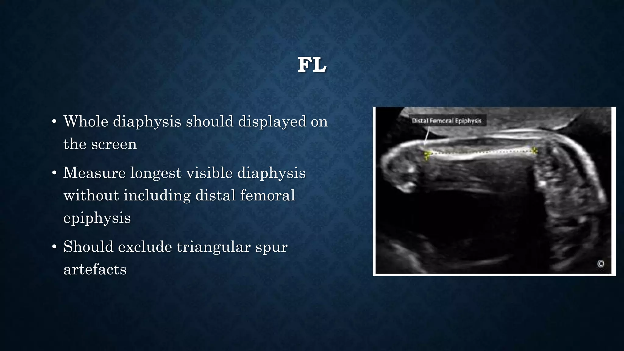 Usg in second trimester | PPTX