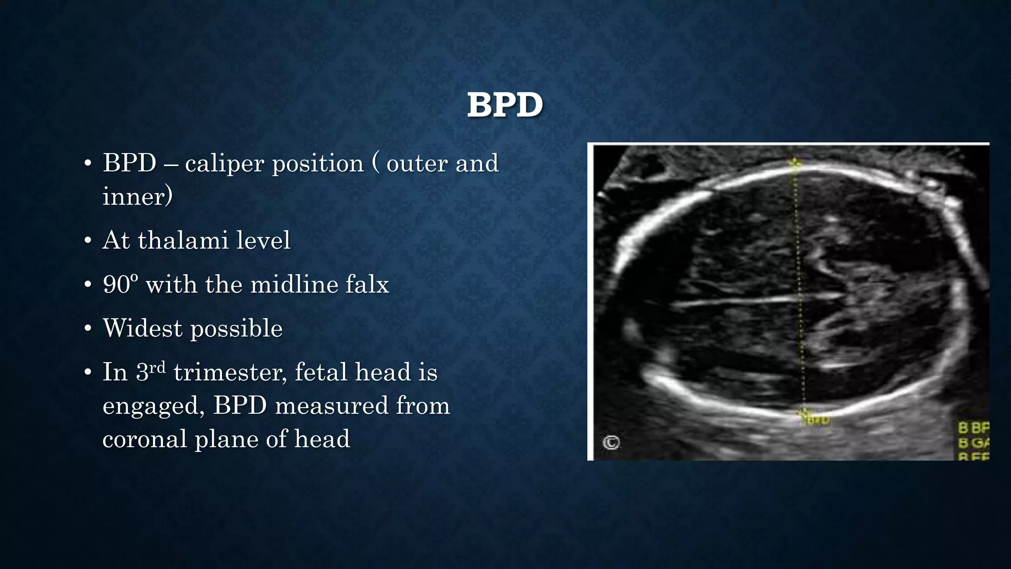 Usg in second trimester | PPTX