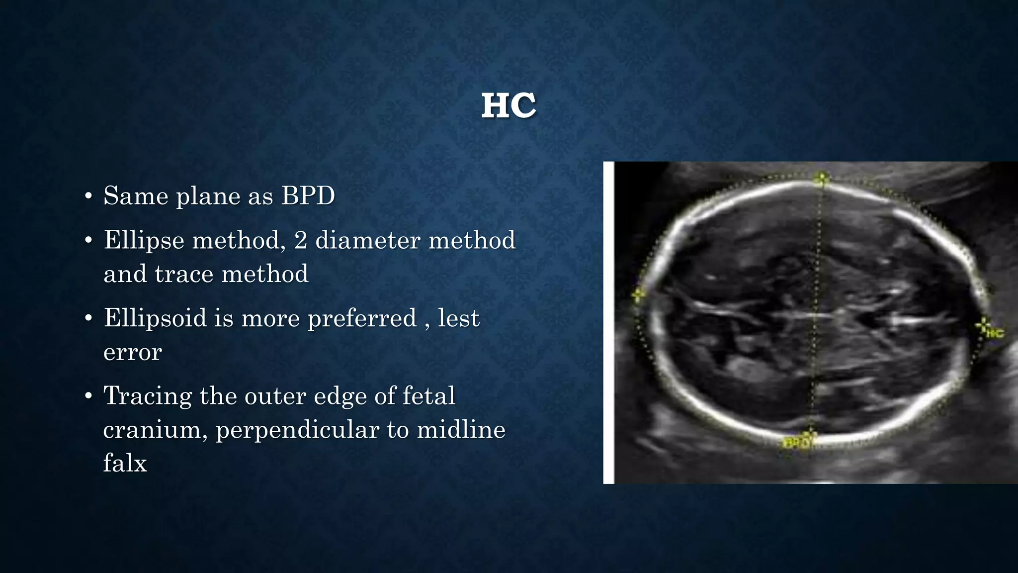 Usg in second trimester | PPTX