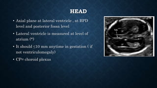 Usg in second trimester | PPTX