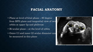 Usg in second trimester | PPTX