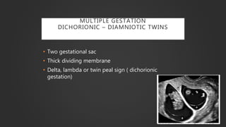 Usg in first trimester | PPTX