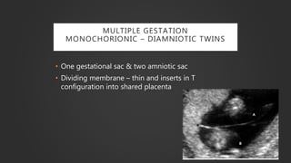 Usg in first trimester | PPTX