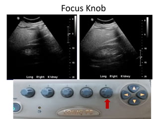 USG basics instruments AND PRINCIPLES.pptx