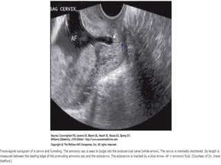 Usg in third trimester | PPTX