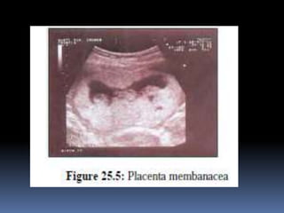 Usg in third trimester | PPTX