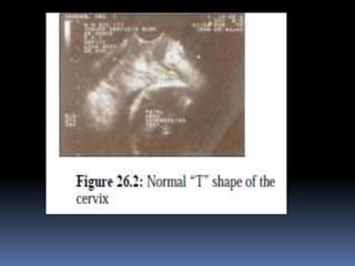 Usg in third trimester | PPTX