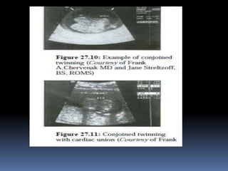 Usg in third trimester | PPTX