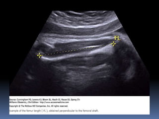 Usg in third trimester | PPTX