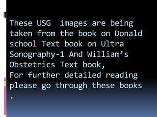 Usg in third trimester | PPTX