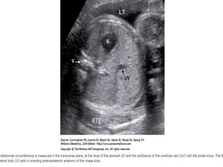 Usg in third trimester | PPTX