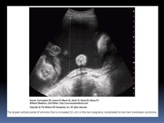 Usg in third trimester | PPTX