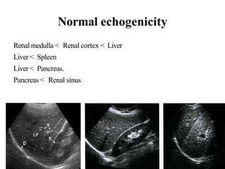 Cirrhosis Ultrasound