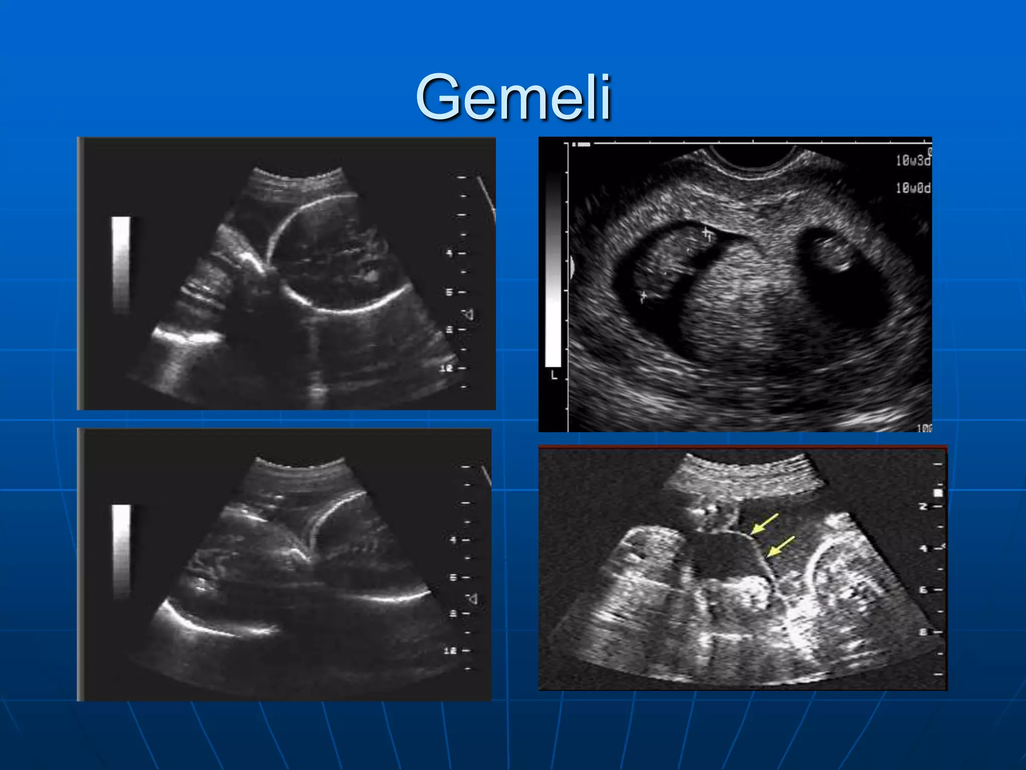 USG dasar dalam kehamilan | PPTX