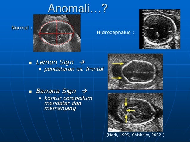 USG dasar dalam kehamilan