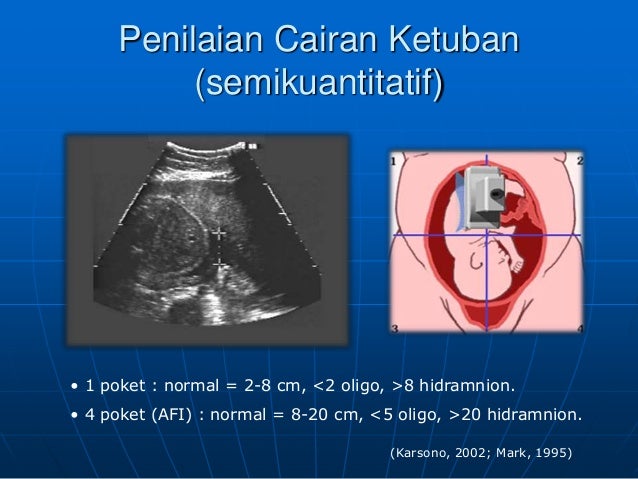 USG dasar dalam kehamilan